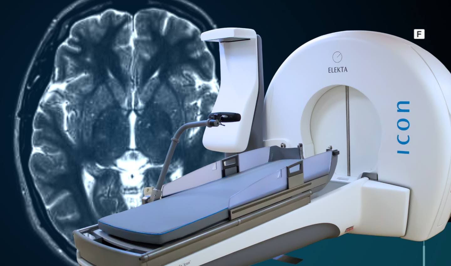 Cirugía Cerebral No Invasiva Con Gamma Knife Innovación Y Seguridad En